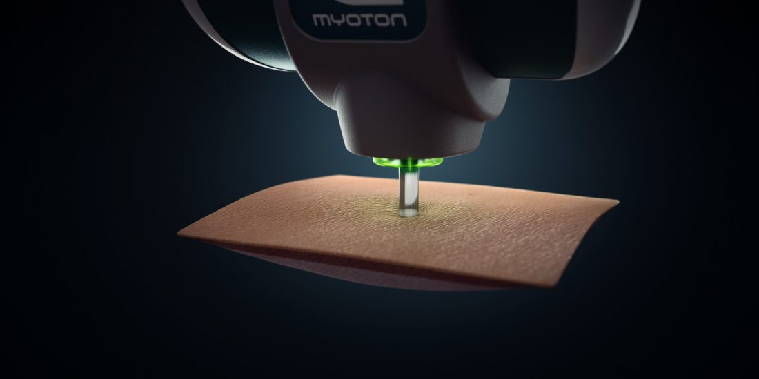 Application - Myoton