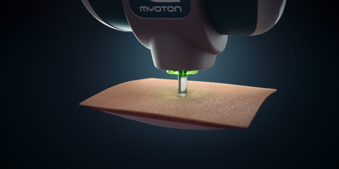 Application - Myoton