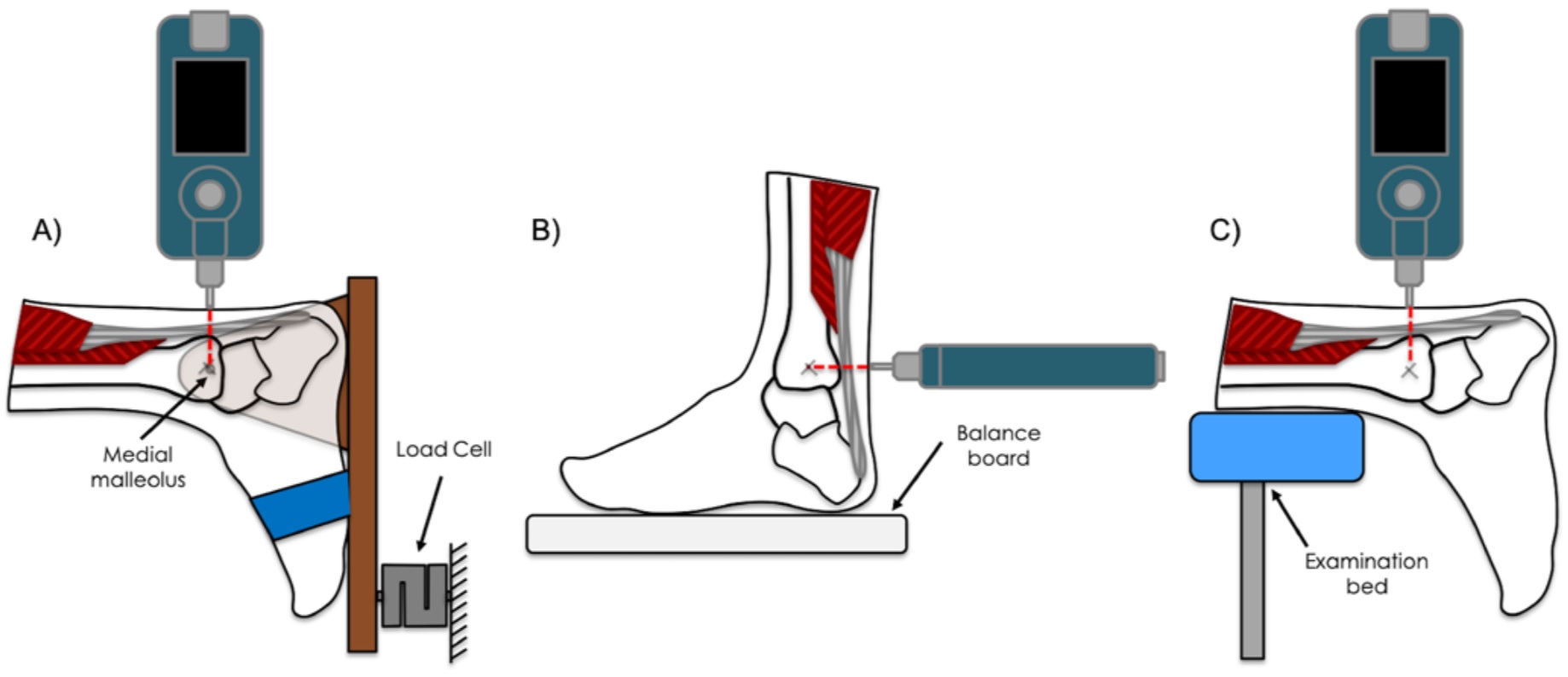 Myotonometry for the evaluation of Achilles tendon mechanical ...
