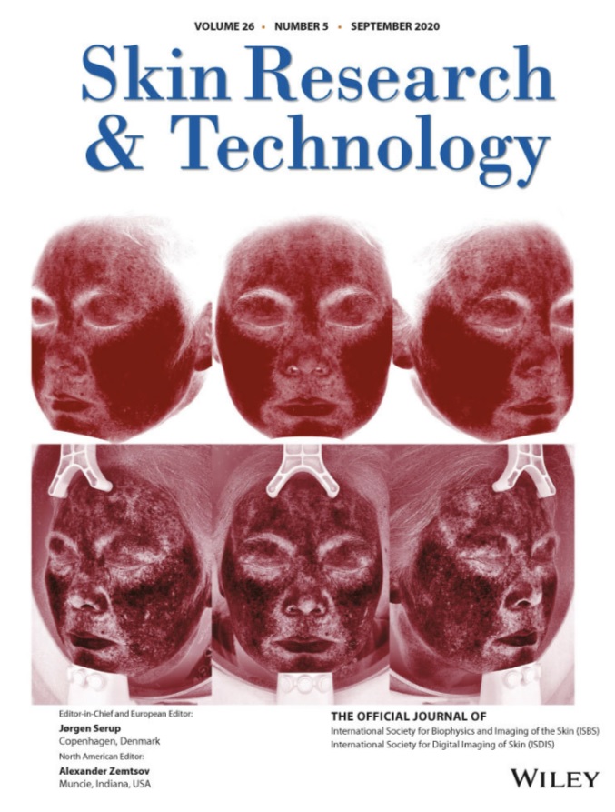 Comparison of different MyotonPRO probes for skin stiffness evaluation ...