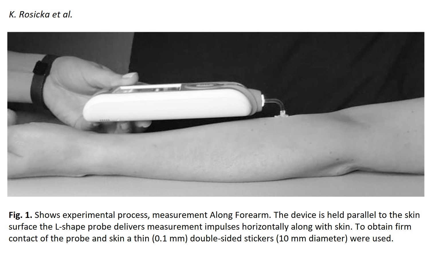 Skin anisotropy: Finding the optimal incision line for volar forearm in ...