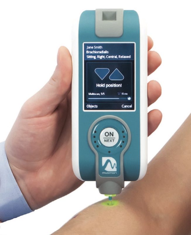 Immediate Effect of Dry Needling on the Viscoelastic Properties of a ...