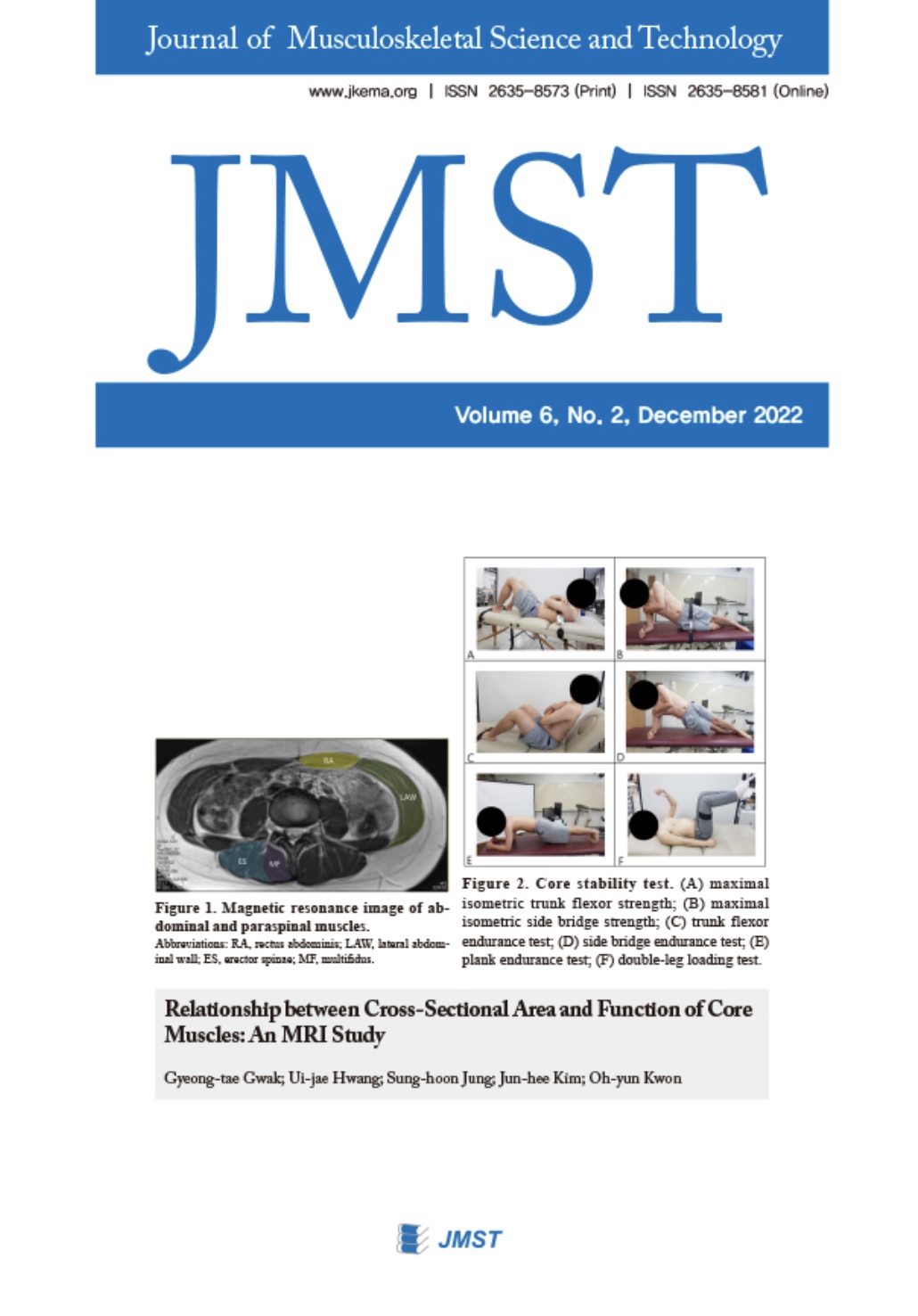 Effect of Active Stretching and Instrument-Assisted Soft Tissue ...