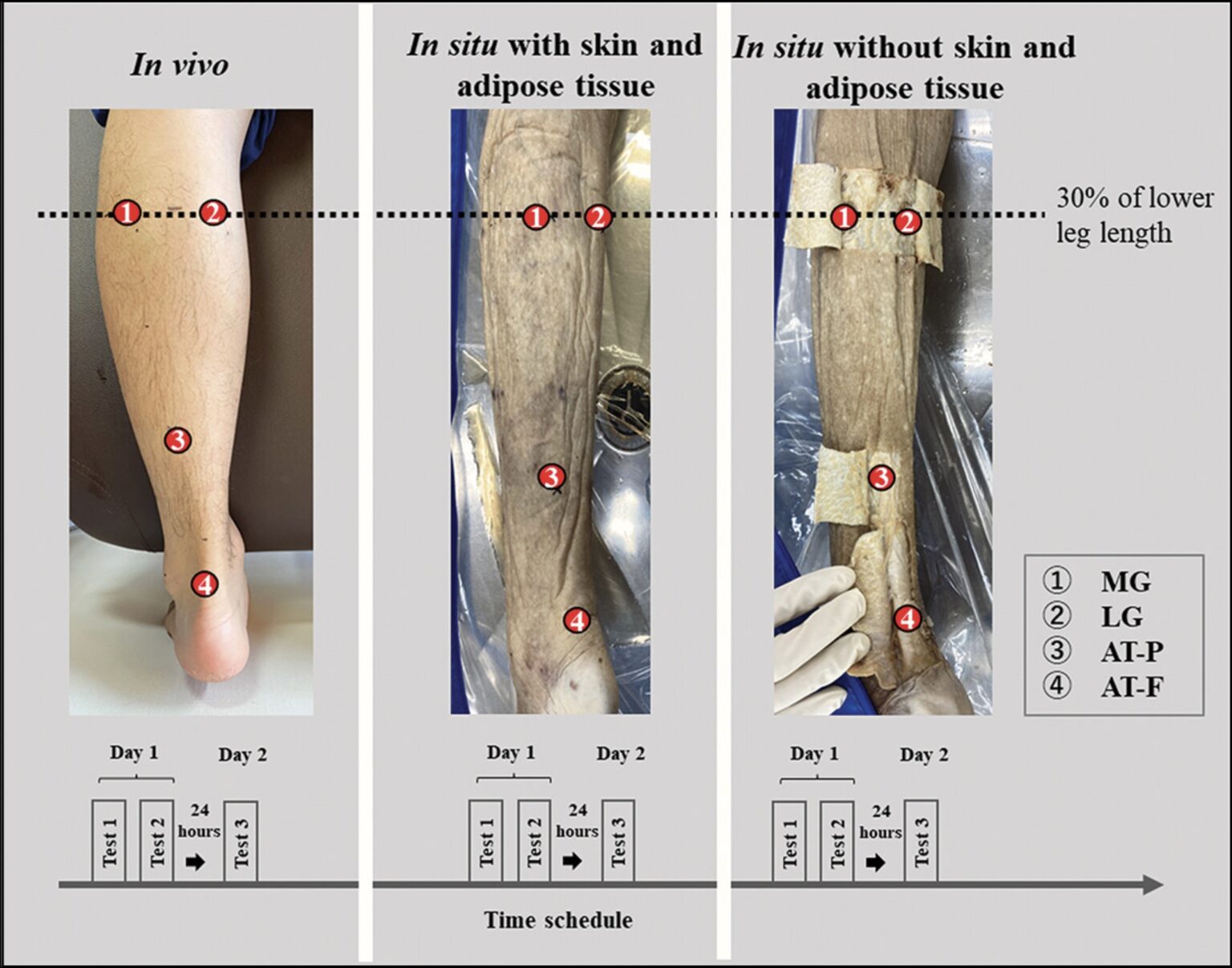 Biomechanical assessment of gastrocnemii and Achilles tendon using ...