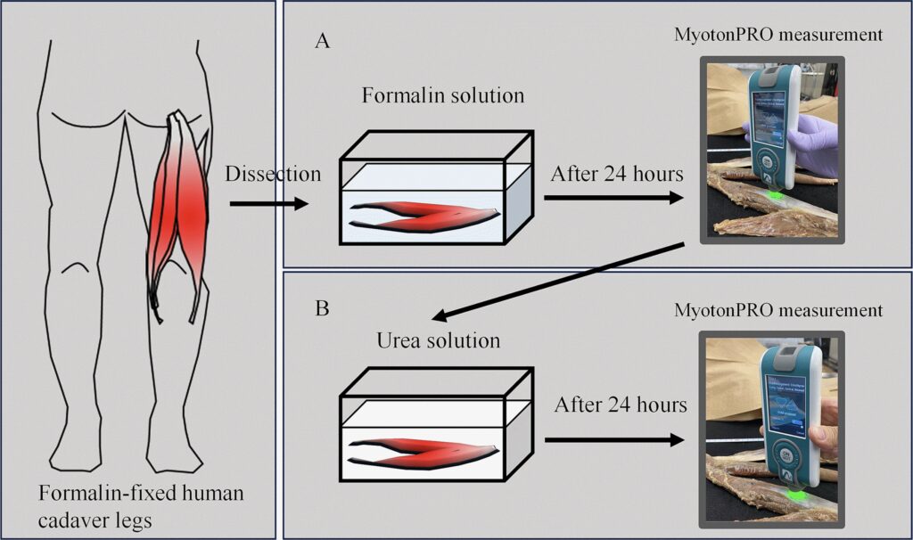 Assessing site-specificity of the biomechanical properties of hamstring ...