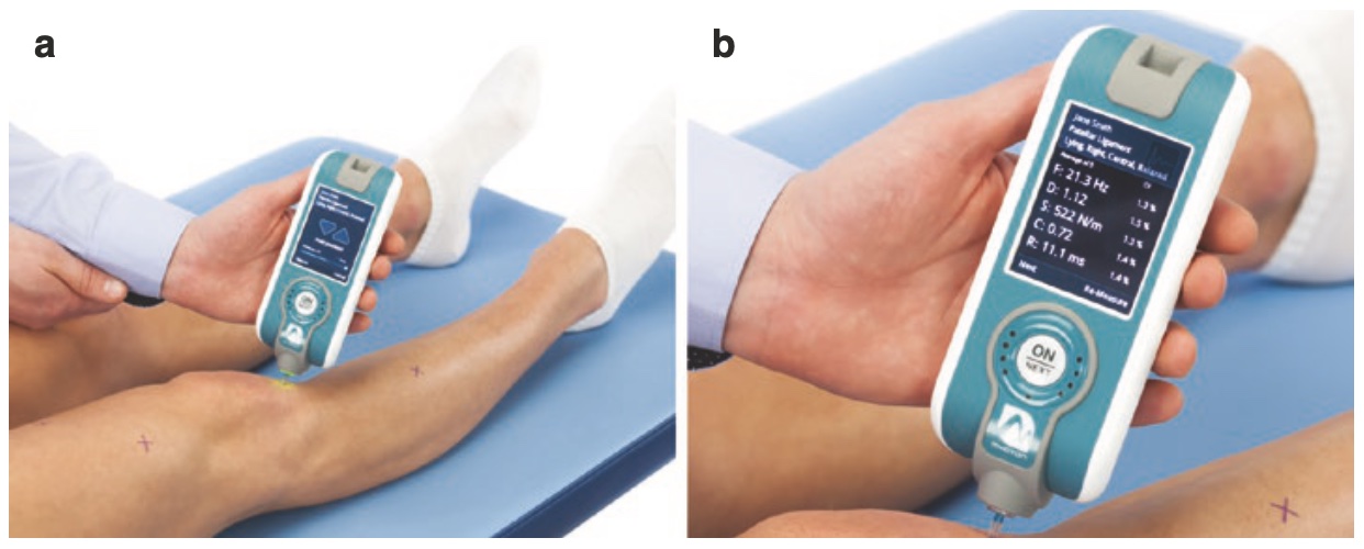 Panoramic Ultrasound Imaging and MyotonPRO - Myoton