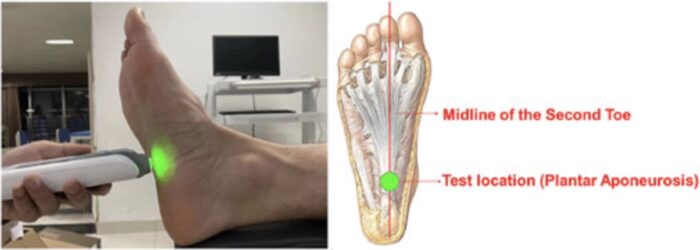 Development of an interpretable model for foot soft tissue stiffness ...