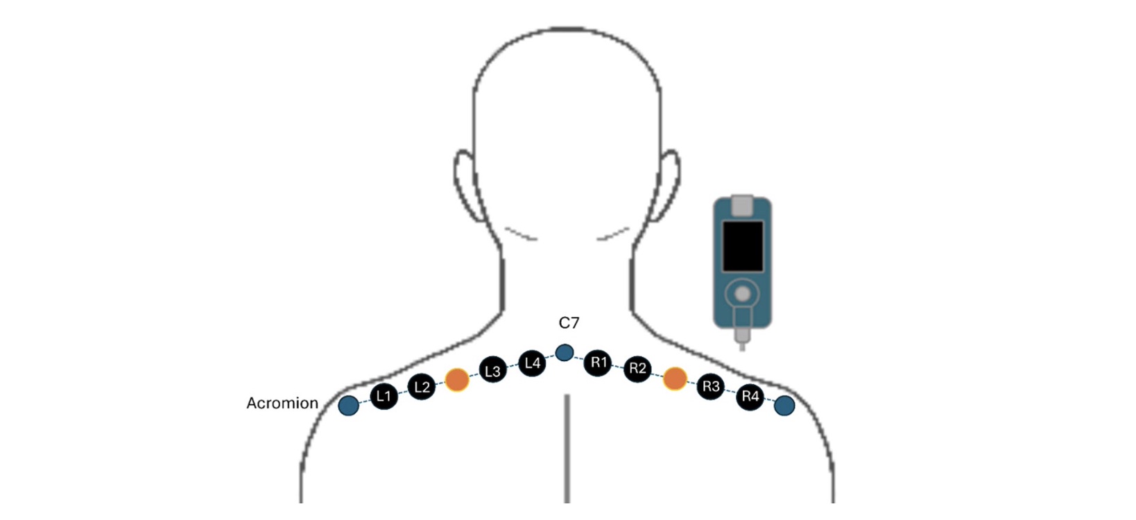 Upper trapezius muscle stiffness among musicians with and without ...